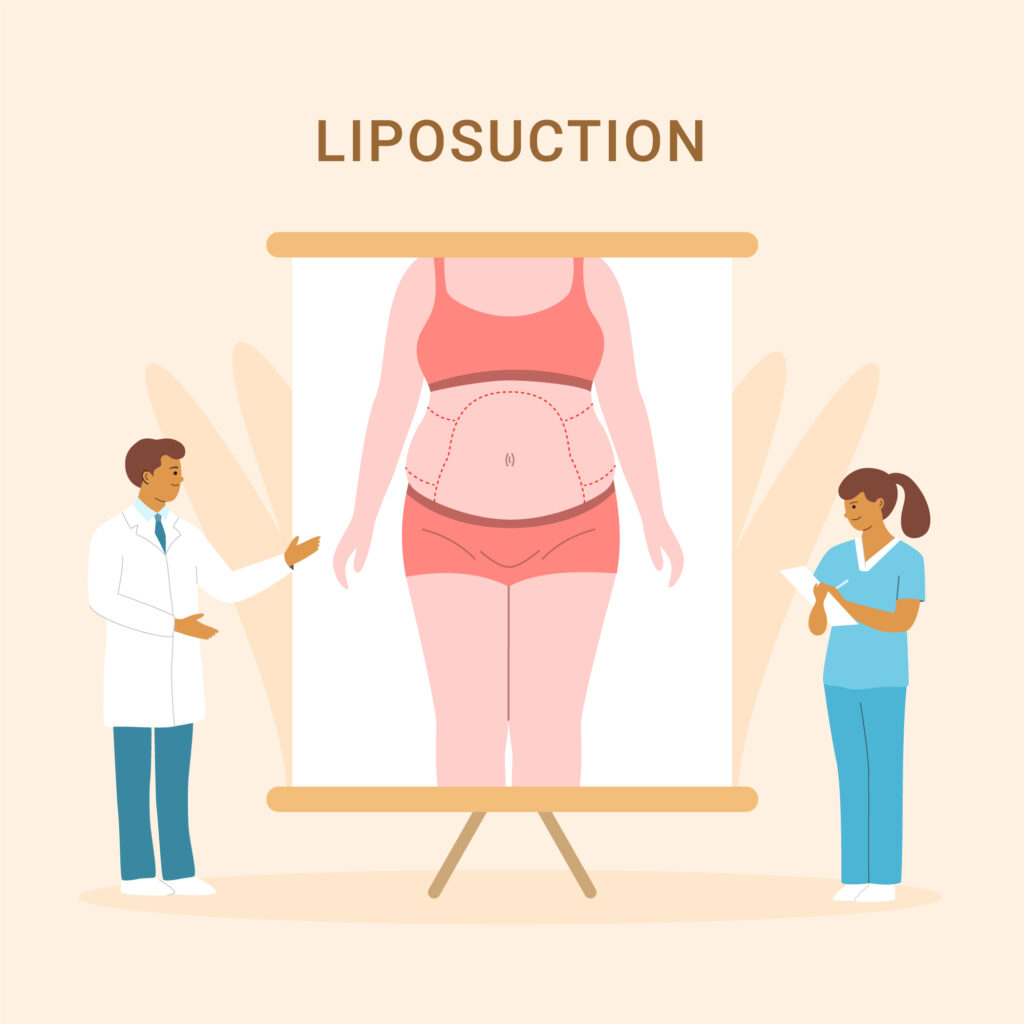 Best Liposuction in Hyderabad for a Sculpted Body - Ojas